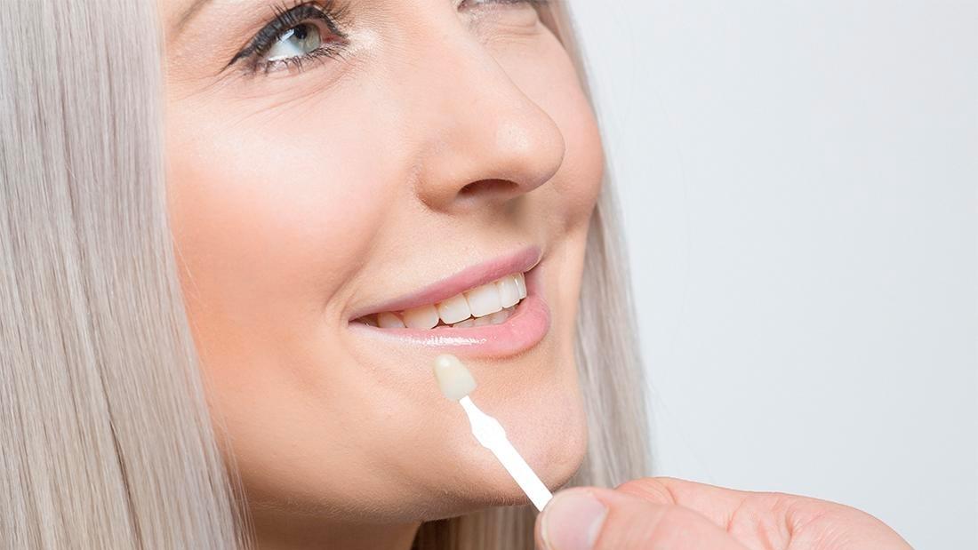 Dental Veneers Put Your Best Tooth Forward | Cosmetic Dentistry Tampa FL